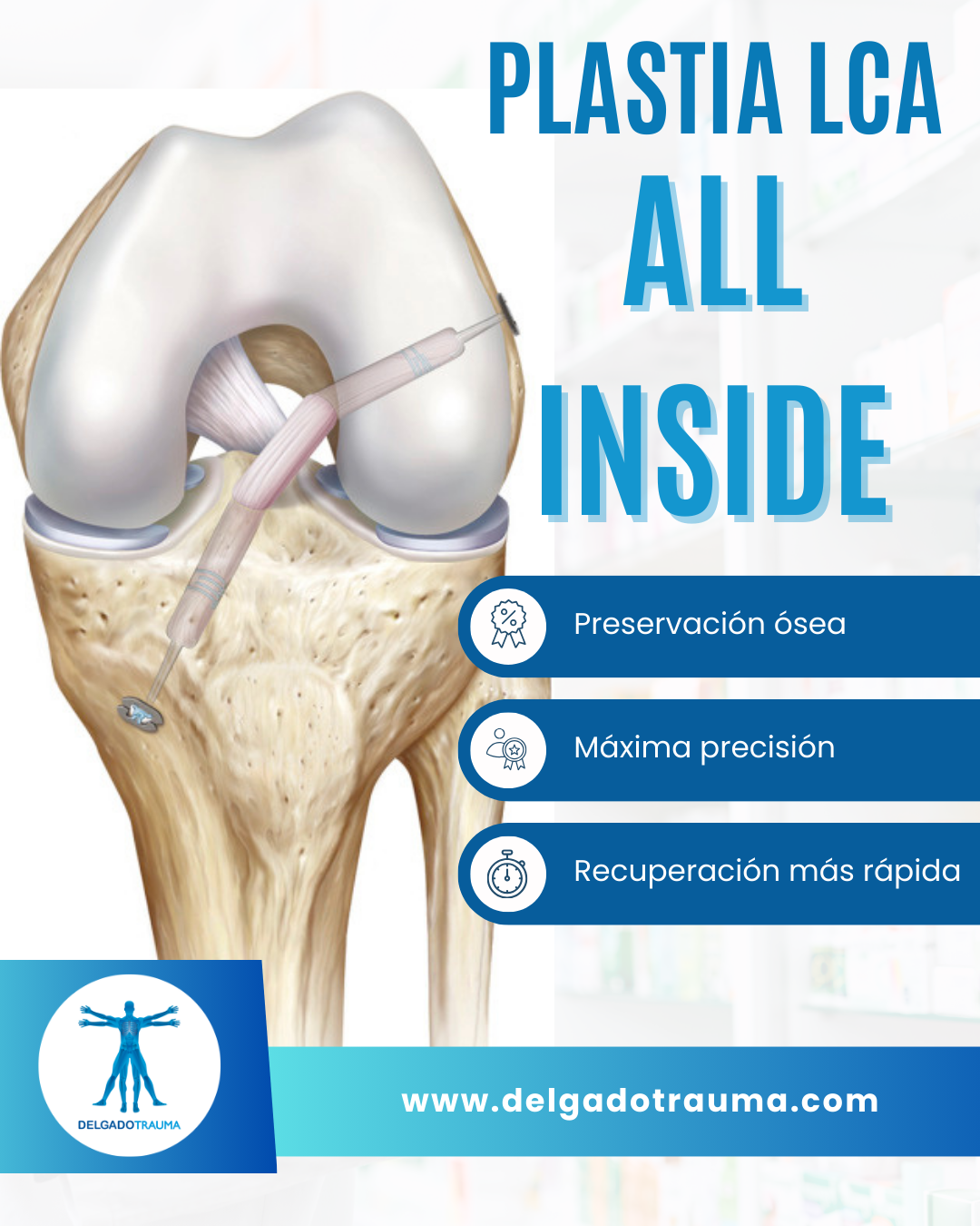 Programa de Rehabilitación para LCA - DELGADOTRAUMA